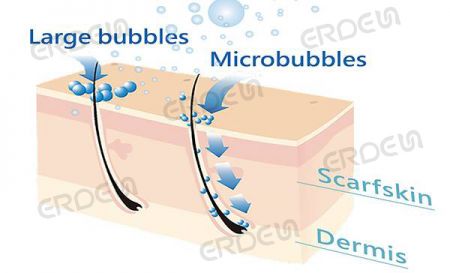 Eco-Bubble Microbubbles Generator | Ozone & Microbubble Clean Systems ...